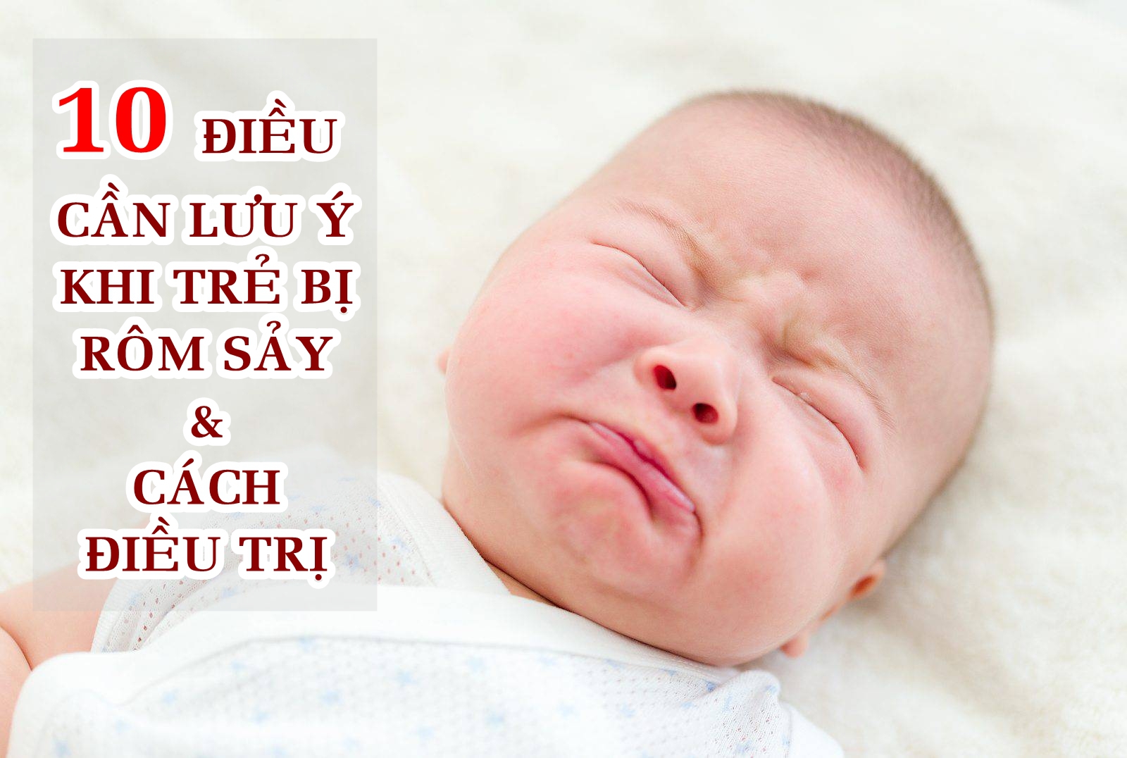 10 điều cần nhớ khi trẻ bị rôm sảy và cách điều trị
