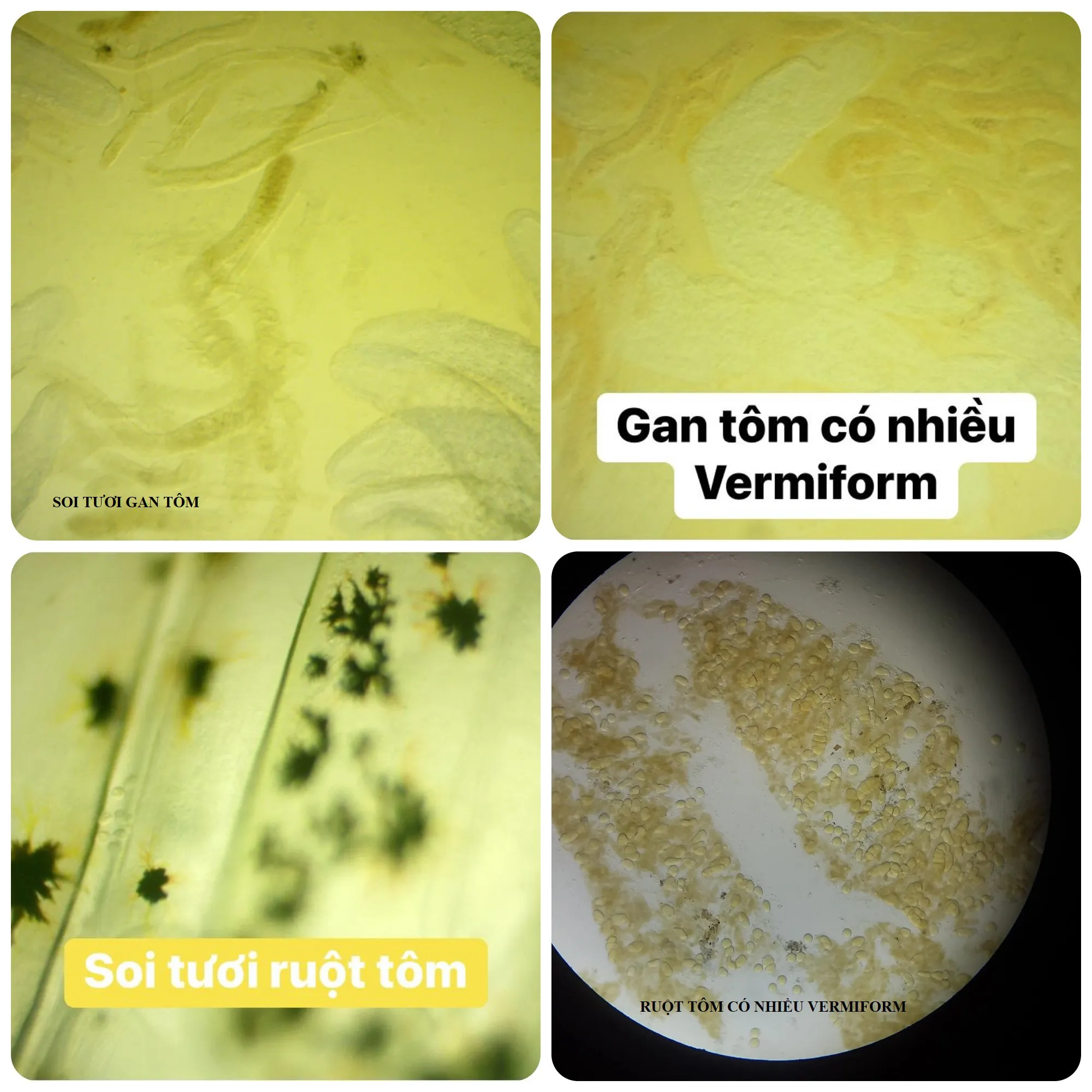 Cách khắc phục ký sinh trùng Vermiform trong ruột và gan tôm