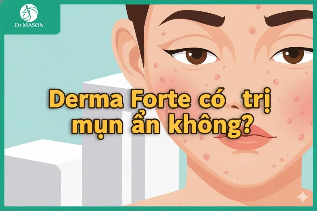 Sự Thật: Derma Forte Có Trị Mụn Dứt Điểm Không? [Bác sĩ Mã Thanh Sơn]