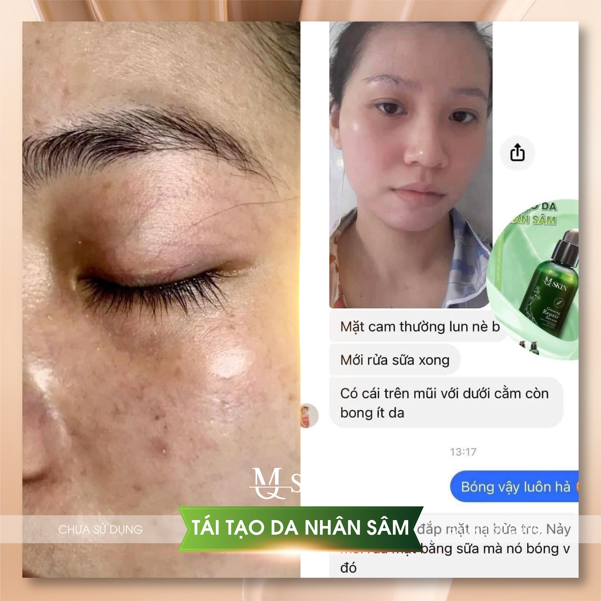 DÙng Serum Thay Da NhÂn SÂm Mqskin Khi NÀo NgƯng BẠn NÊn BiẾt